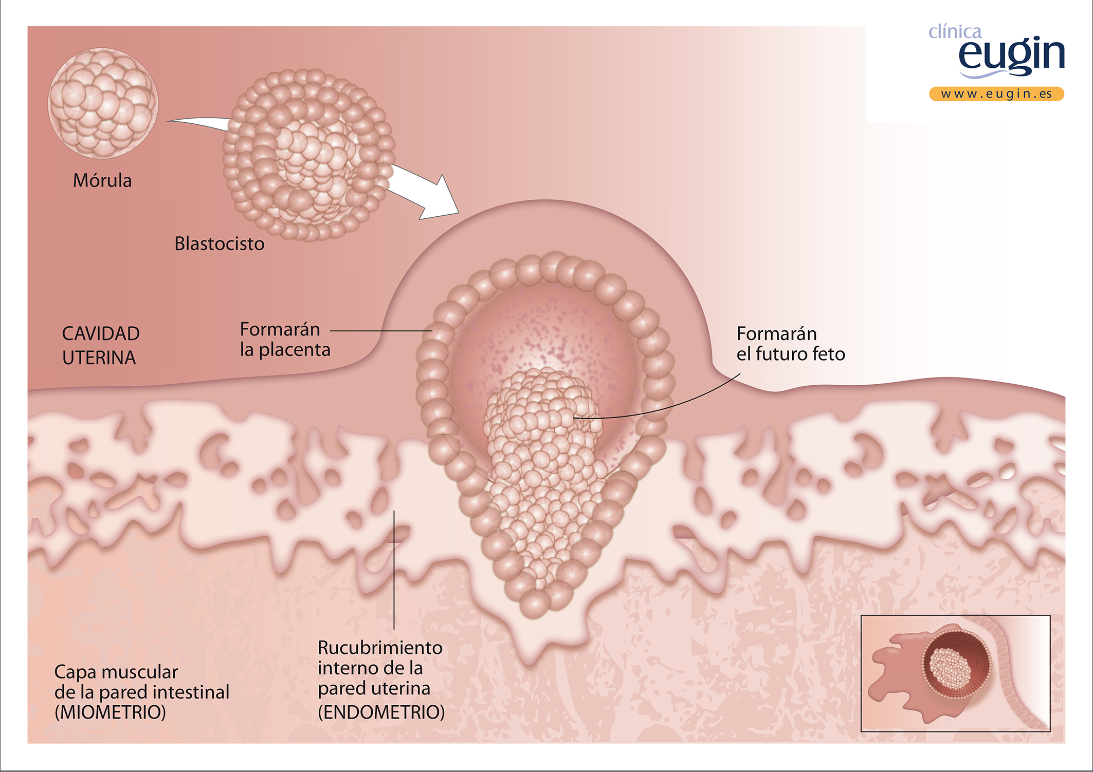 Info. Implantación de Embrión – xaviisern estudi